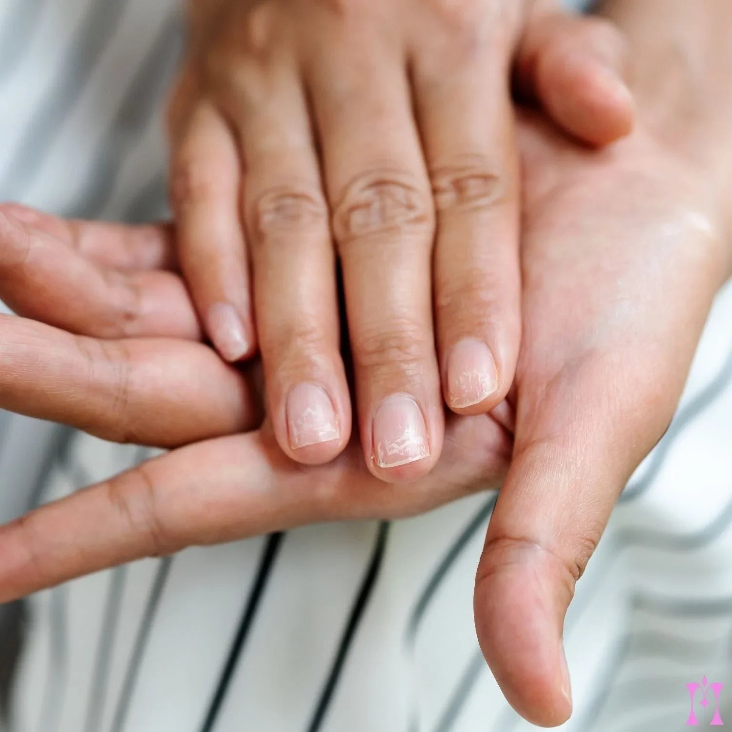 How to Repair Broken, Weak, Brittle Nails | Causes, Fixes & Care – mesme